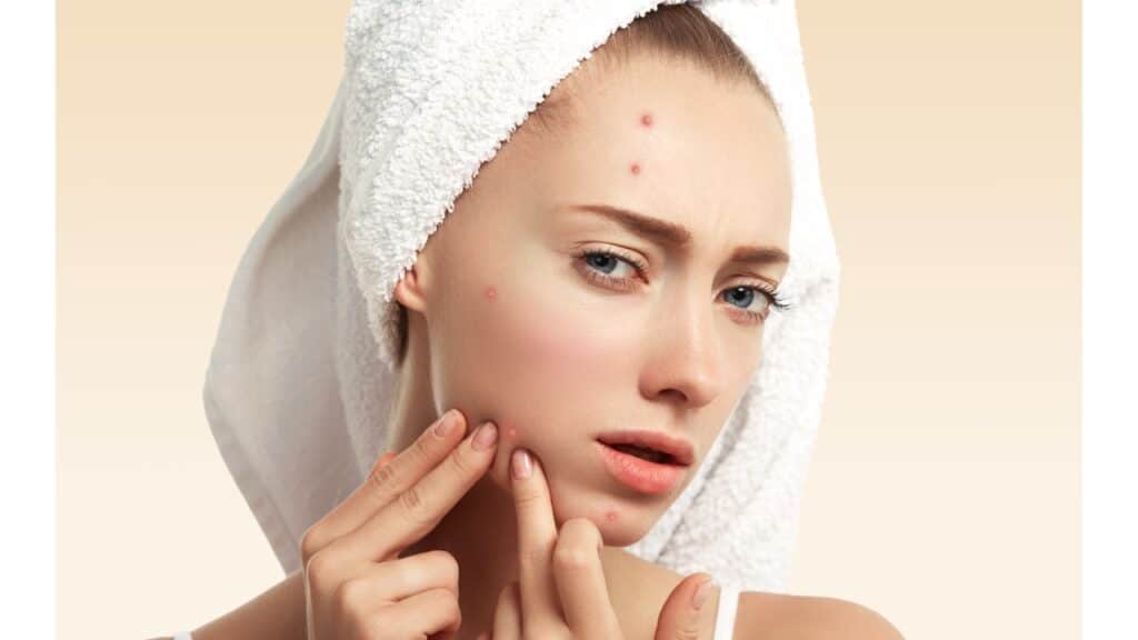 Cómo hacer un jabón anti acné para suavizar tu rostro de forma natural