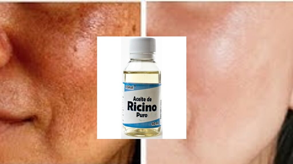 Cómo usar aceite de ricino para quitar las manchas del rostro
